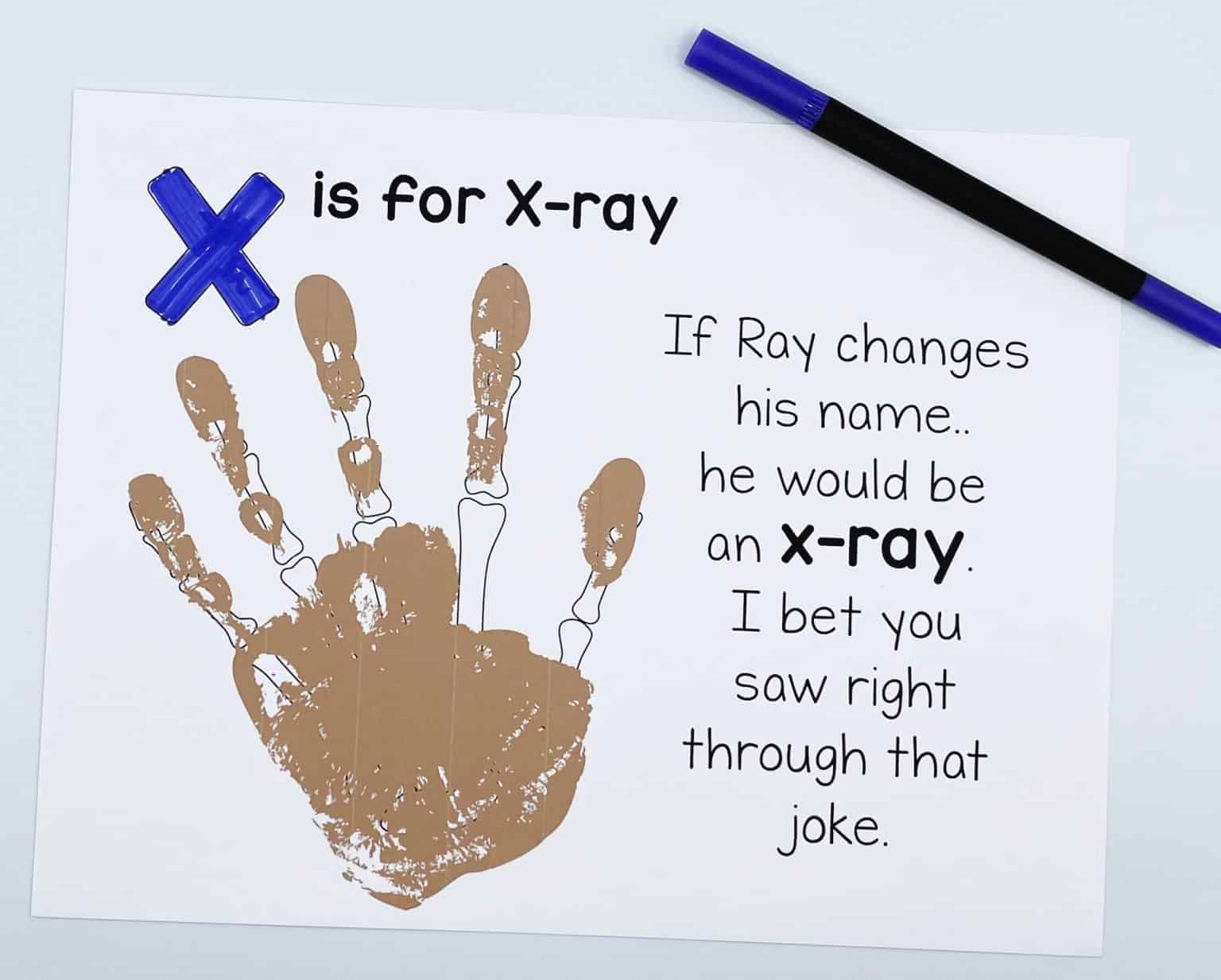 X is for X-Ray Handprint Art: Have Fun With the Letter X